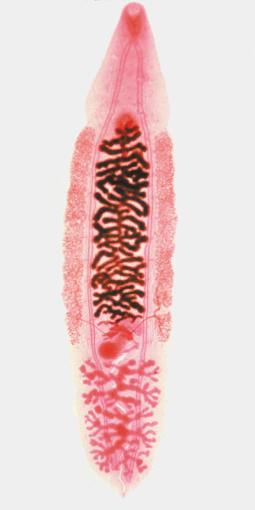 clonorchis under microscope