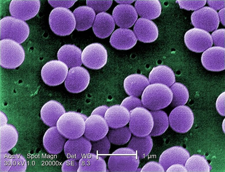 purple bacteria examples